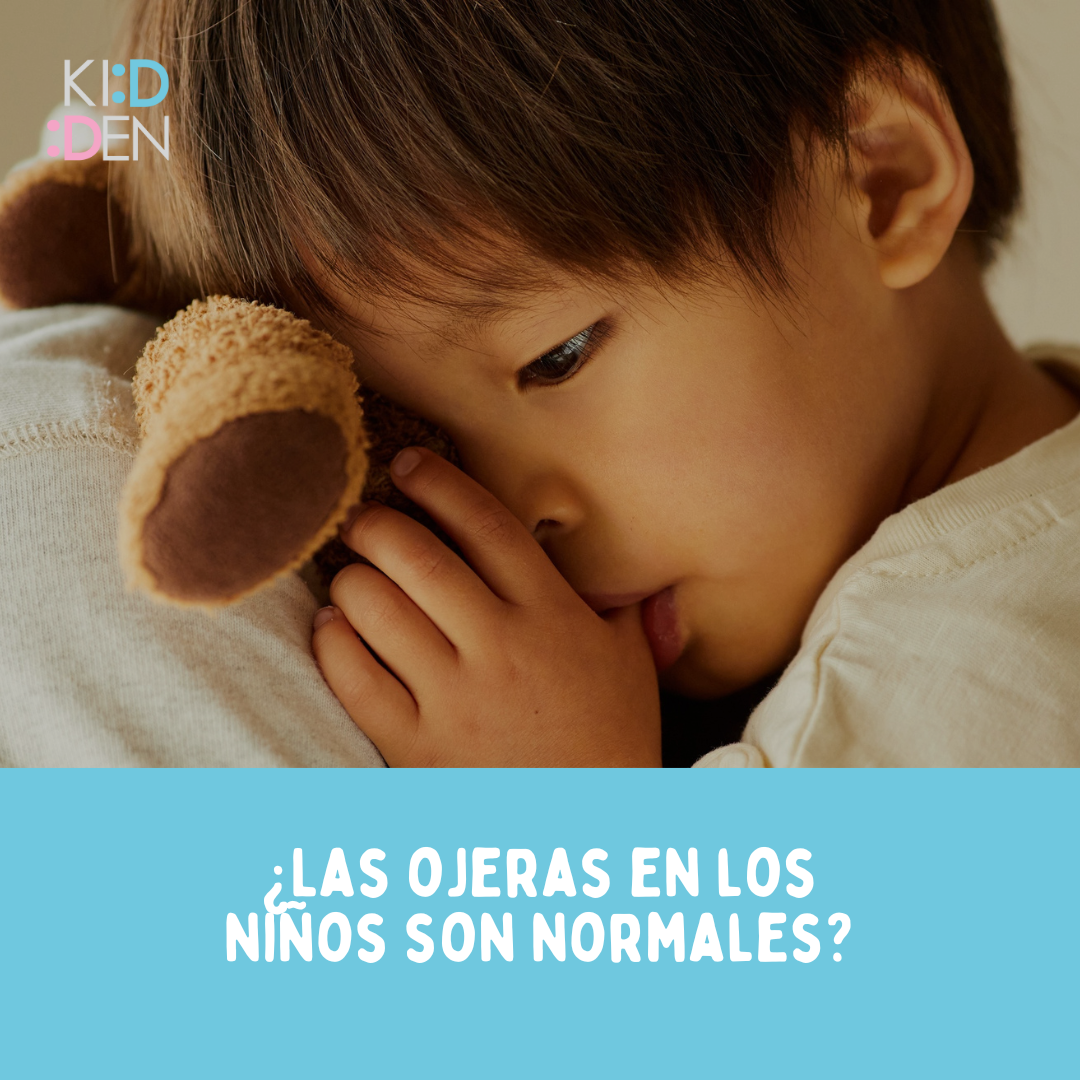 ¿Las ojeras en los niños son normales? - kidden